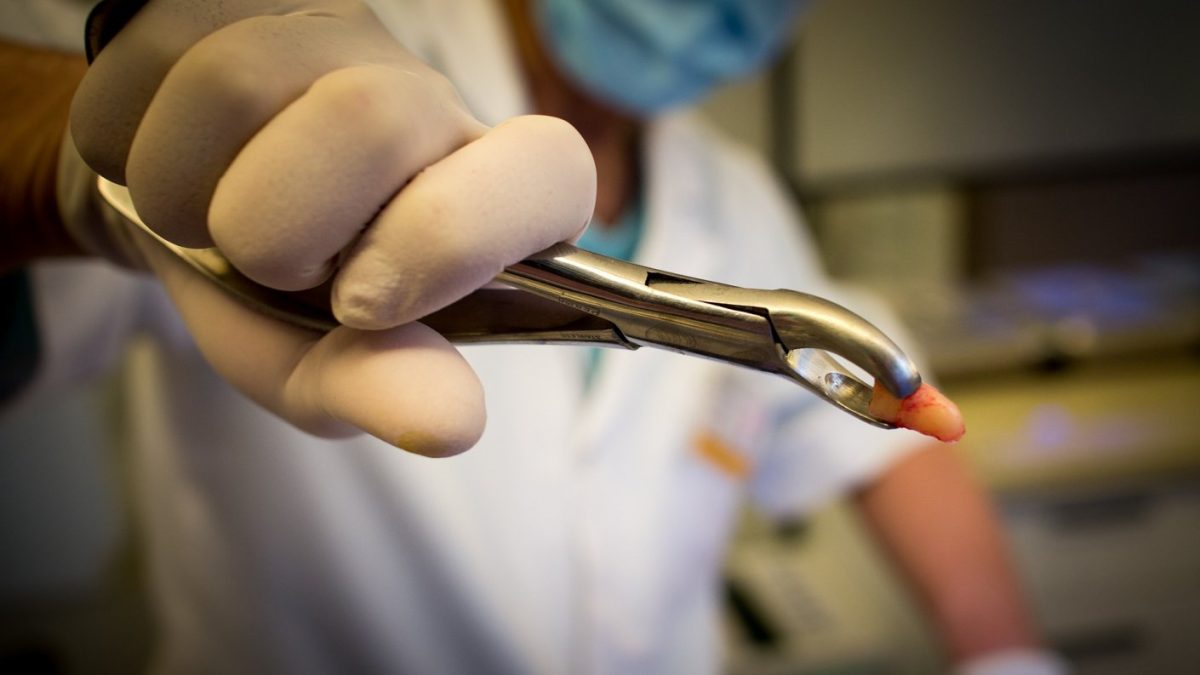 Detienen a mujer que se hizo pasar por dentista: Le extrajo 13 dientes ...