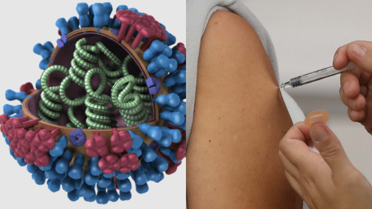 Qué es la influenza tipo A, cómo se transmite y cuál es la población de ...